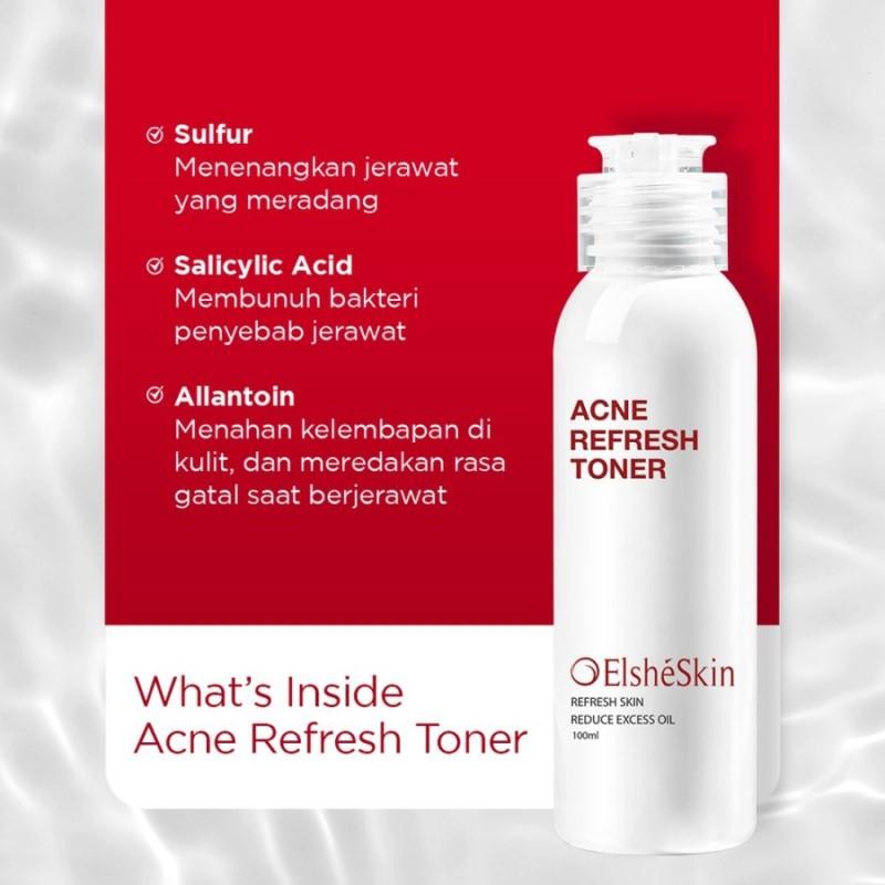 Jual Elshe Skin Acne Refresh Toner 100ml Termurah Mei 2025 | Beautyhaul