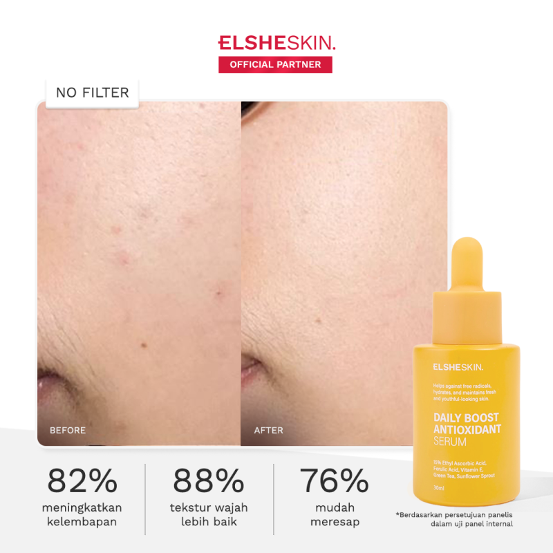 PROMO Elshe Skin Daily Boost Antioxidant Serum FREE ONGKIR