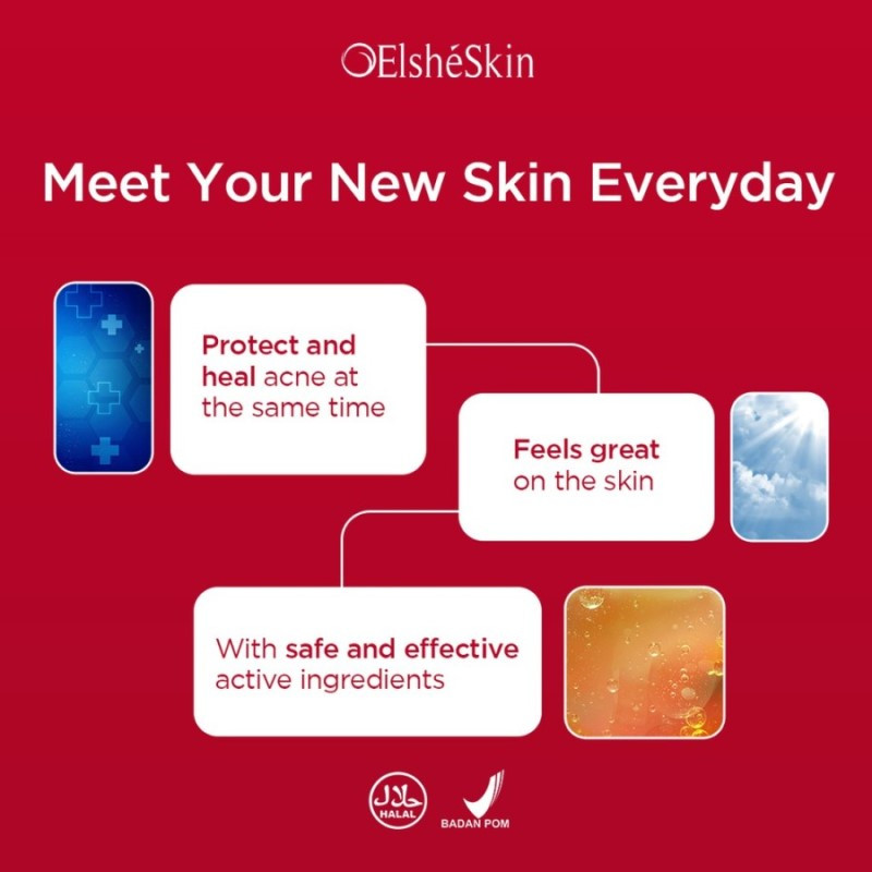 Jual Elshe Skin Daily Protection FOR Acne Skin Termurah April 2025 ...