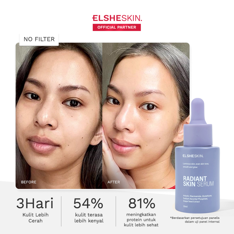 PROMO Elshe Skin Radiant Skin Serum FREE ONGKIR