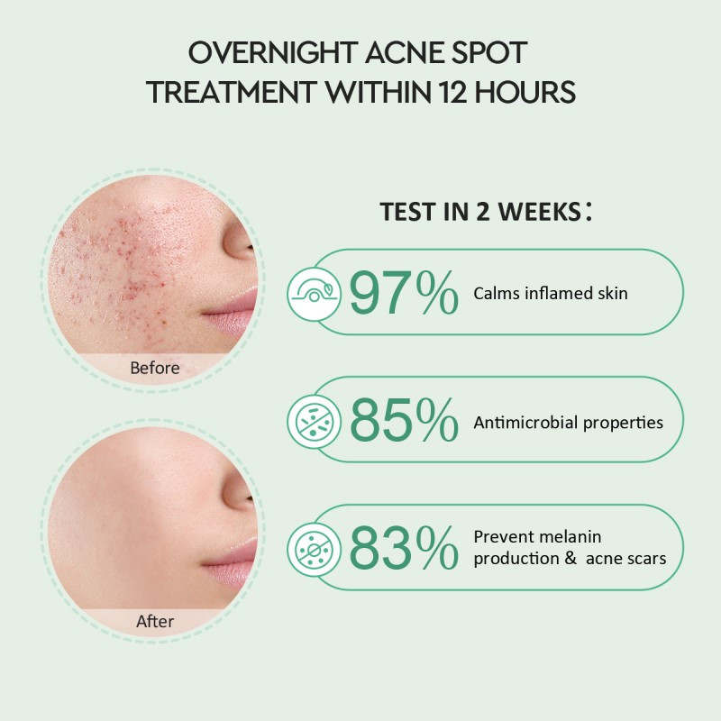 PROMO Glad2glow Centella 2% Salicylic Acid Overnight Acne Spot ...