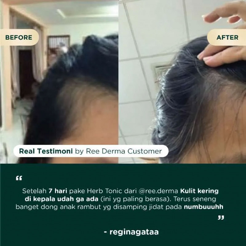 PROMO Ree Derma Herb Tonic FREE ONGKIR
