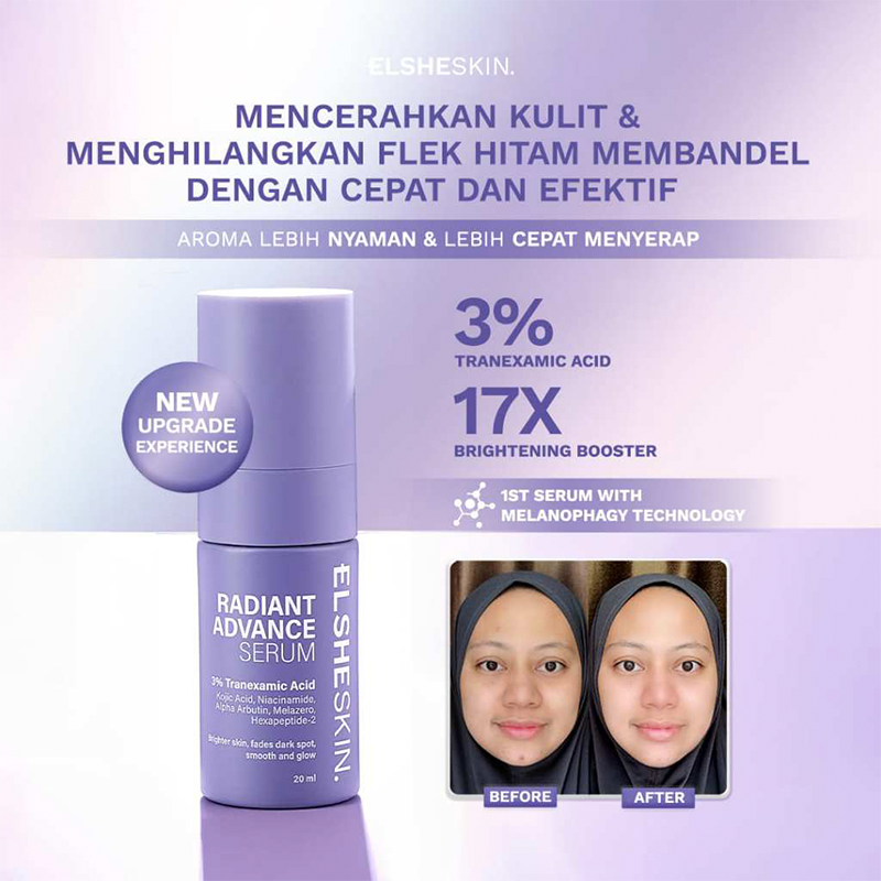 PROMO Elshe Skin Radiant Advance Serum FREE ONGKIR