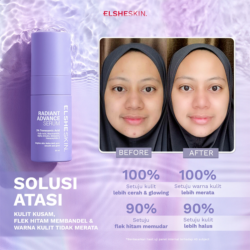 PROMO Elshe Skin Radiant Advance Serum FREE ONGKIR