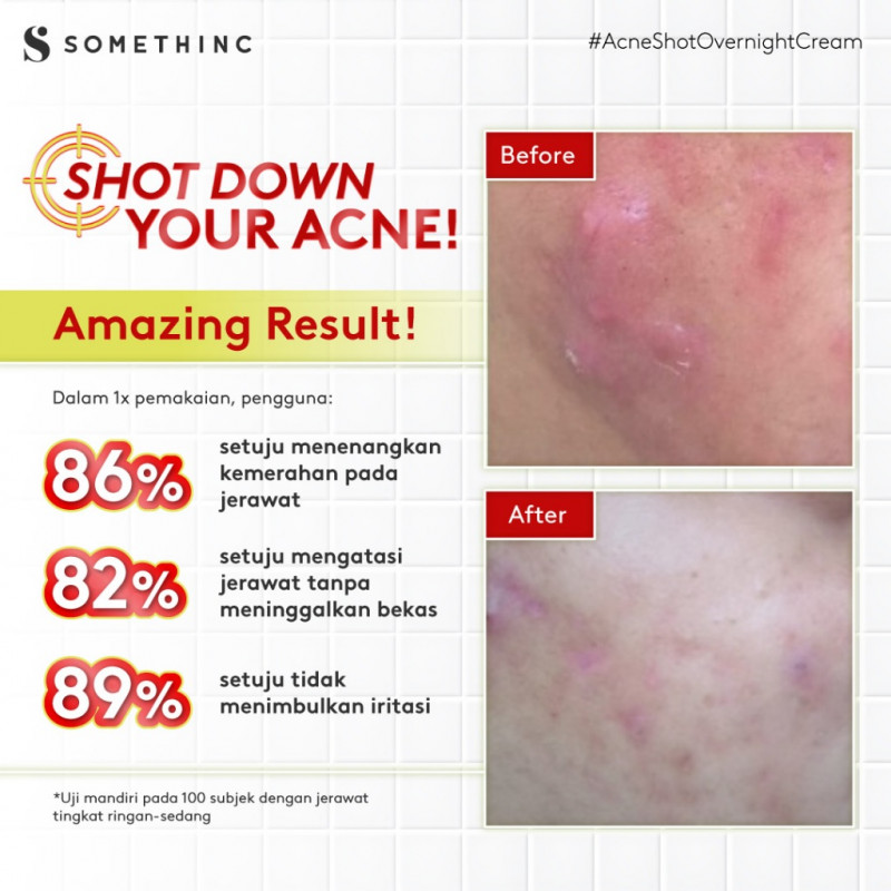 PROMO Somethinc ACNE SHOT AC Overnight Treatment Spot Cream FREE ONGKIR