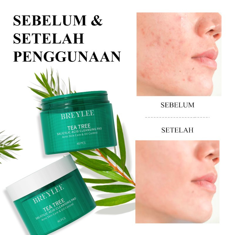 PROMO Breylee Tea Tree Salicylic Acid Cleansing Pad FREE ONGKIR
