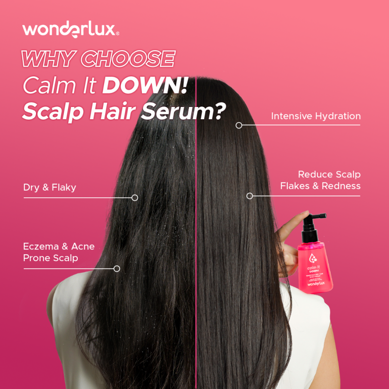 PROMO Wonderlux Calm it Down! Sensitive & Dry Care Scalp Serum FREE ONGKIR