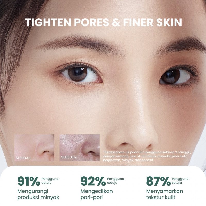 PROMO You Beauty AcnePlus Fine Pore Oil Control Serum FREE ONGKIR