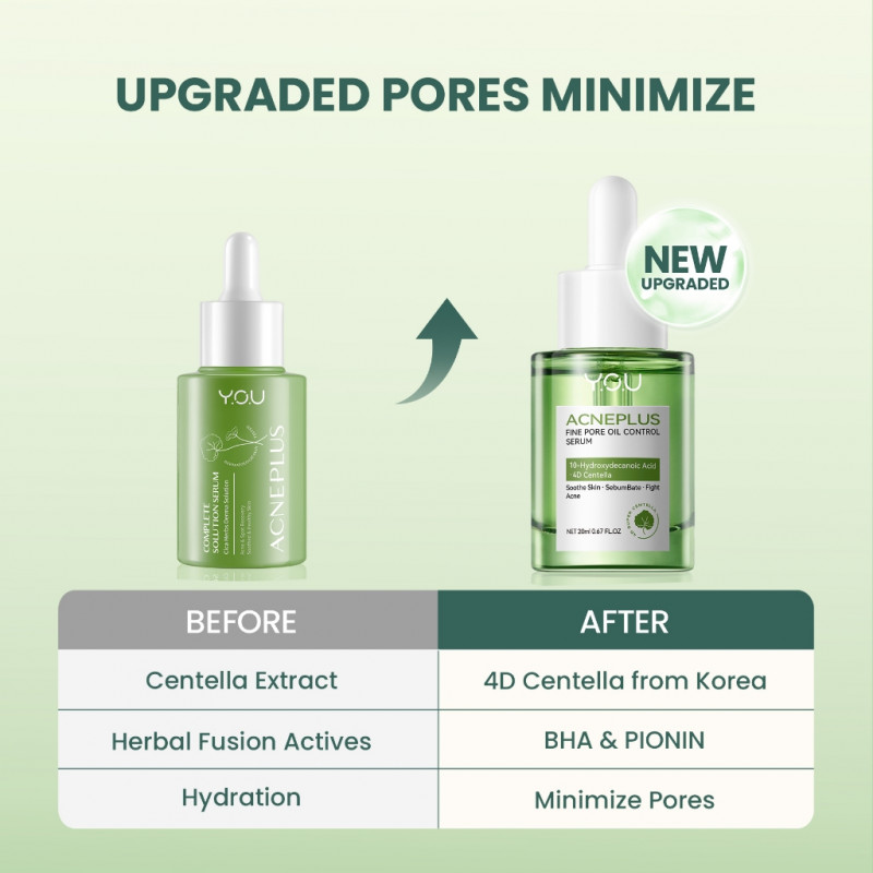 PROMO You Beauty AcnePlus Fine Pore Oil Control Serum FREE ONGKIR
